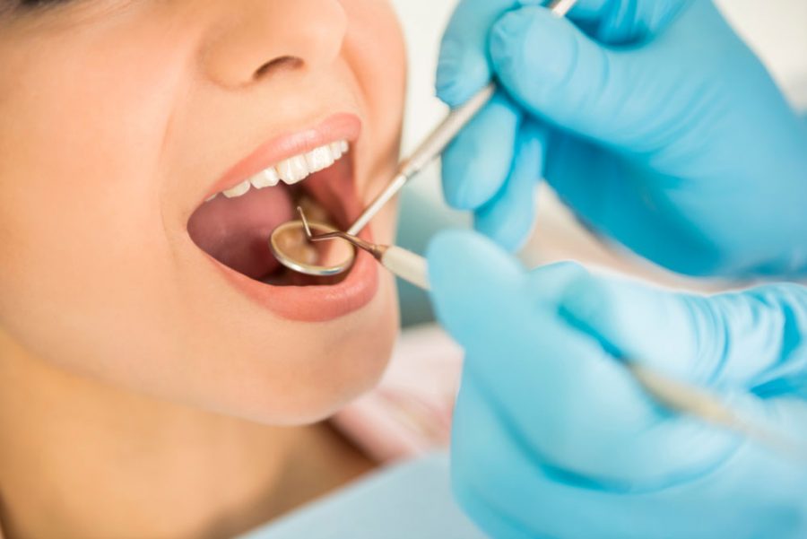 Why Do You Need a Crown After Root Canal Treatment?
